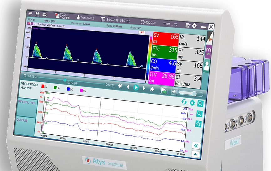 Cardiac Output Monitor